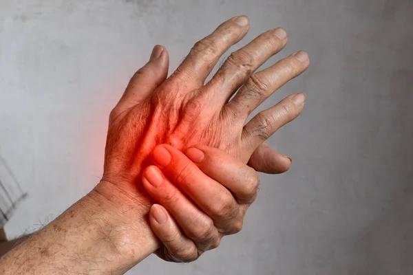 Hand Pain Images - Search Images on Everypixel