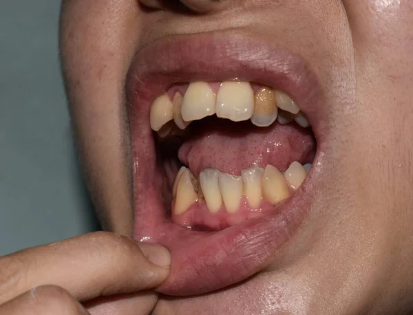 Asian toothache Stock Photos, Royalty Free Asian toothache Images ...