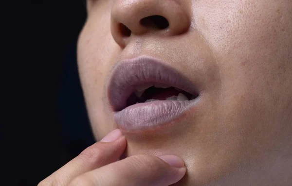 Cyanosis Stock Photos, Royalty Free Cyanosis Images | Depositphotos