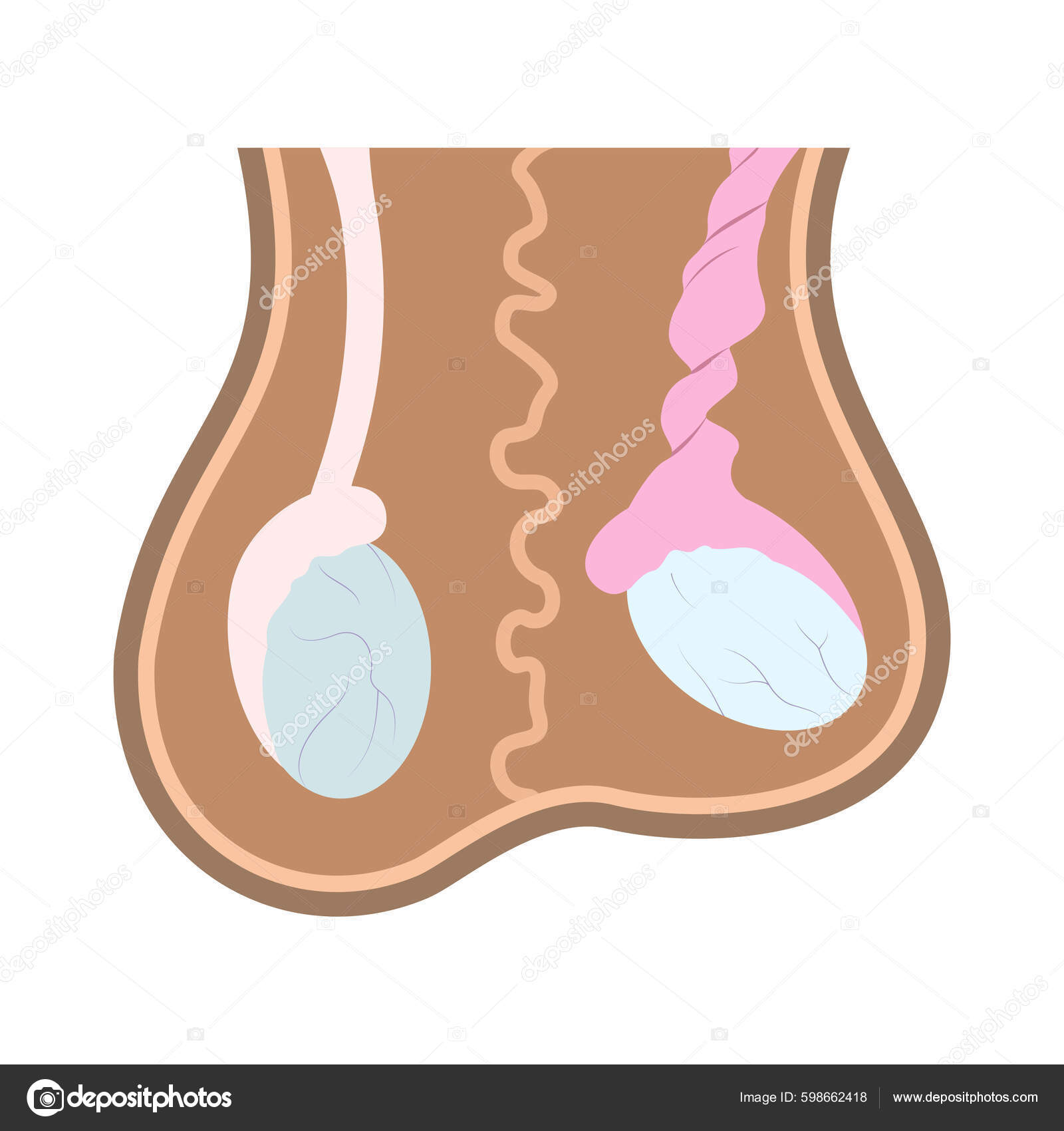Illustration Normal Testicle Testicle Torsion Scrotum Medical Chart
