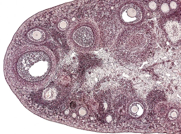 Prometaphase Stock Photos, Royalty Free Prometaphase Images | Depositphotos