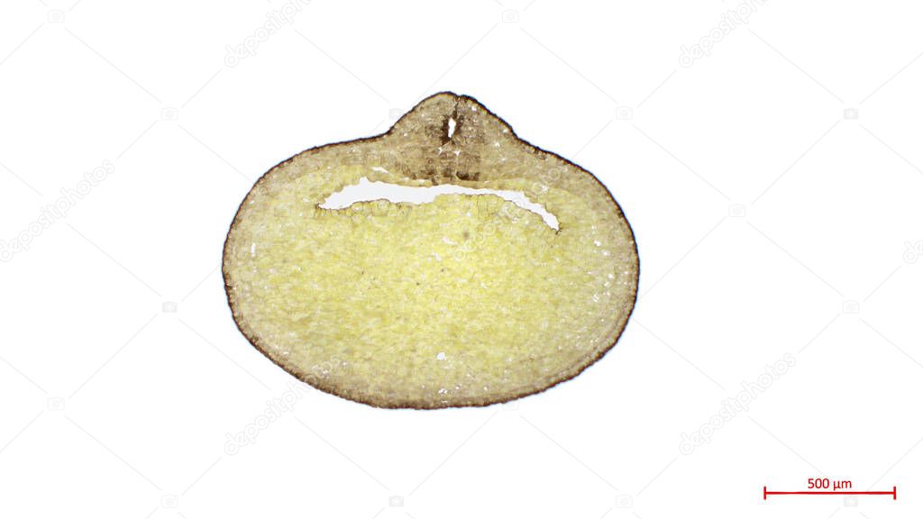 Neurulation, light micrograph (developing frog egg). Transverse section ...