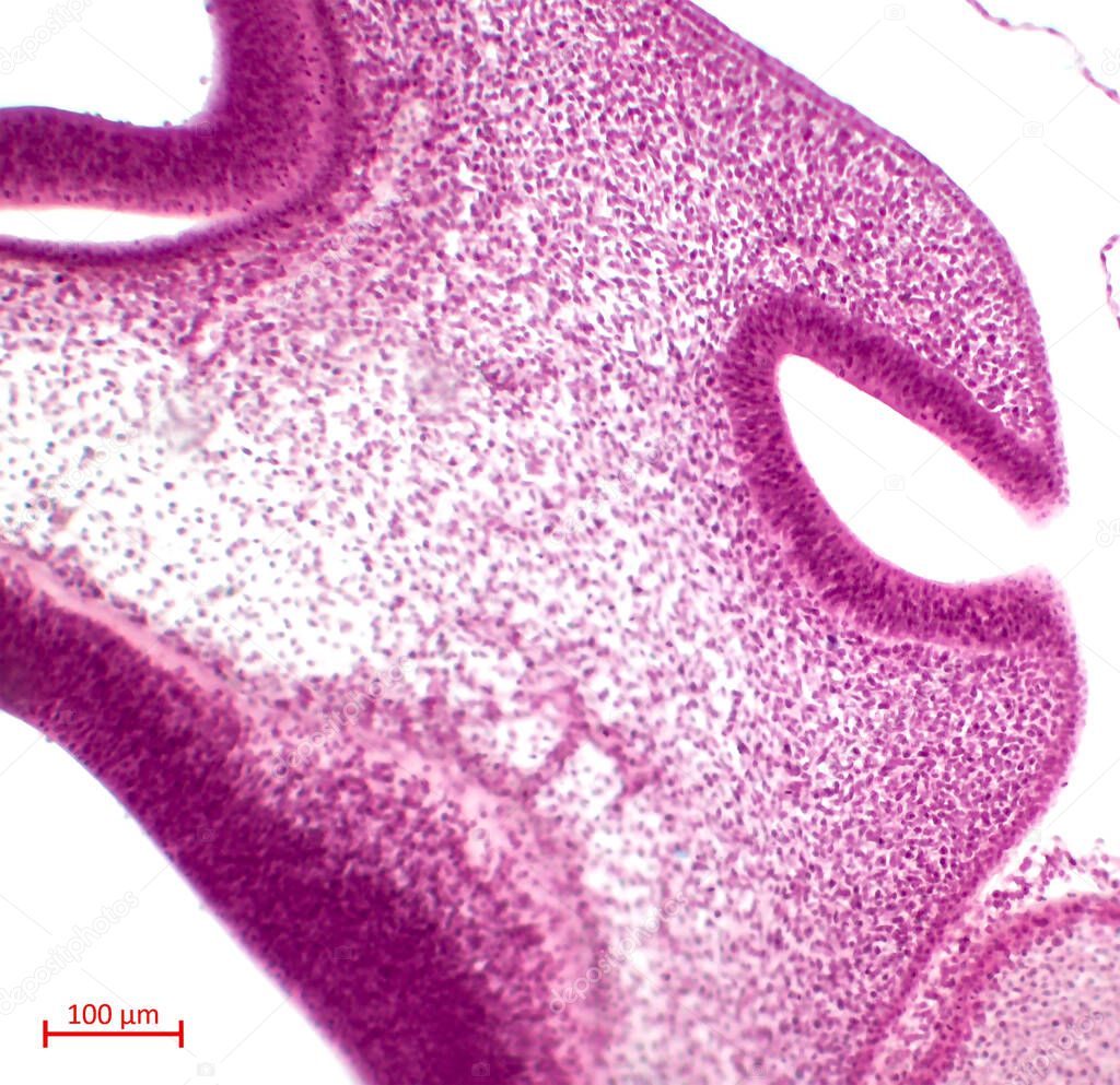 Olfactory organ development. Olfactory fossa pit stage. Hematoxylin and ...