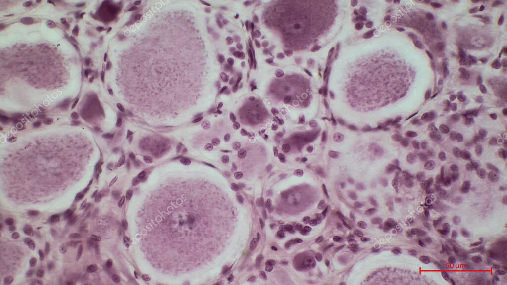 Primer plano de las neuronas pseudounipolares del ganglio nervioso ...