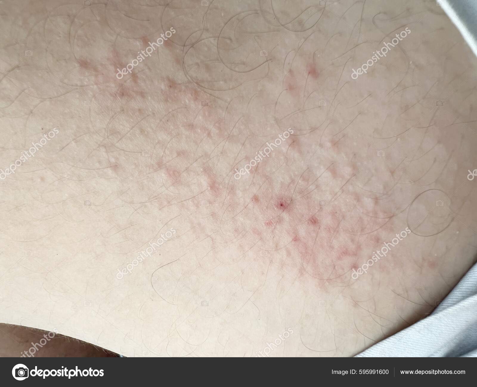 Close Female Hand Needle — Stock Photo © pongsak14 #595991600