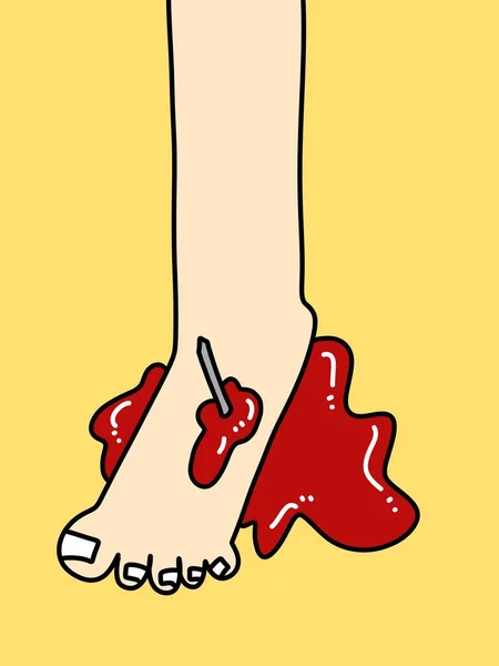 Bleeding leg Stock Photos, Royalty Free Bleeding leg Images | Depositphotos