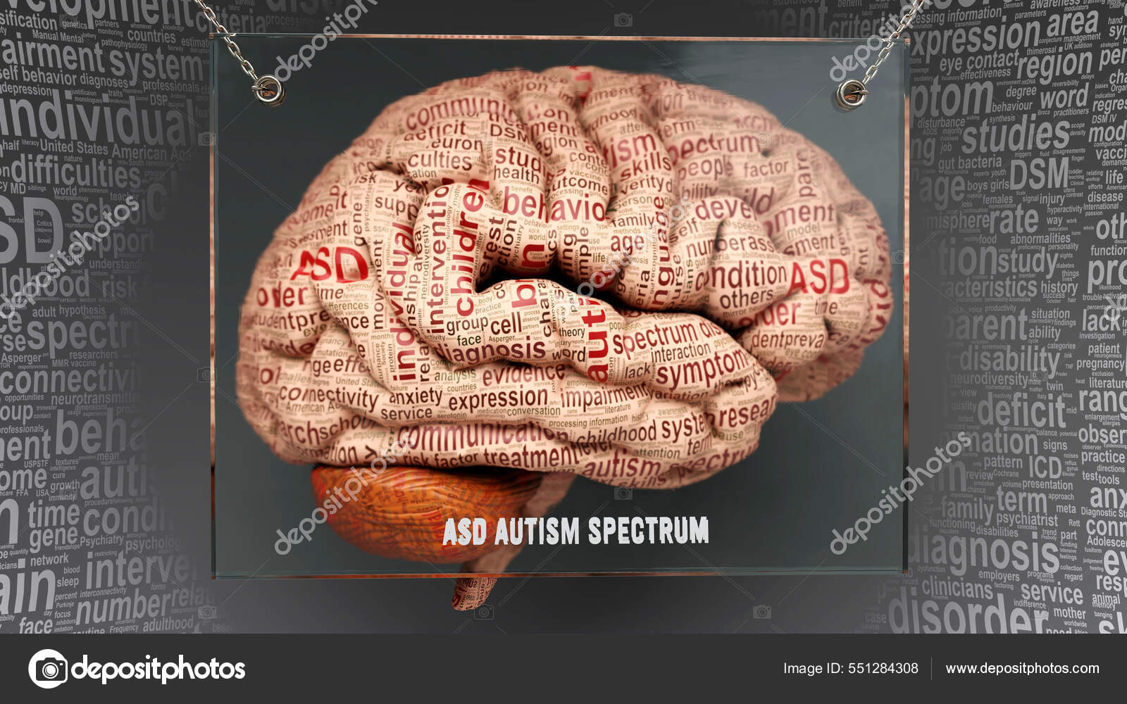 Asd Autism Spectrum Anatomy Its Causes Effects Projected Human Brain ...