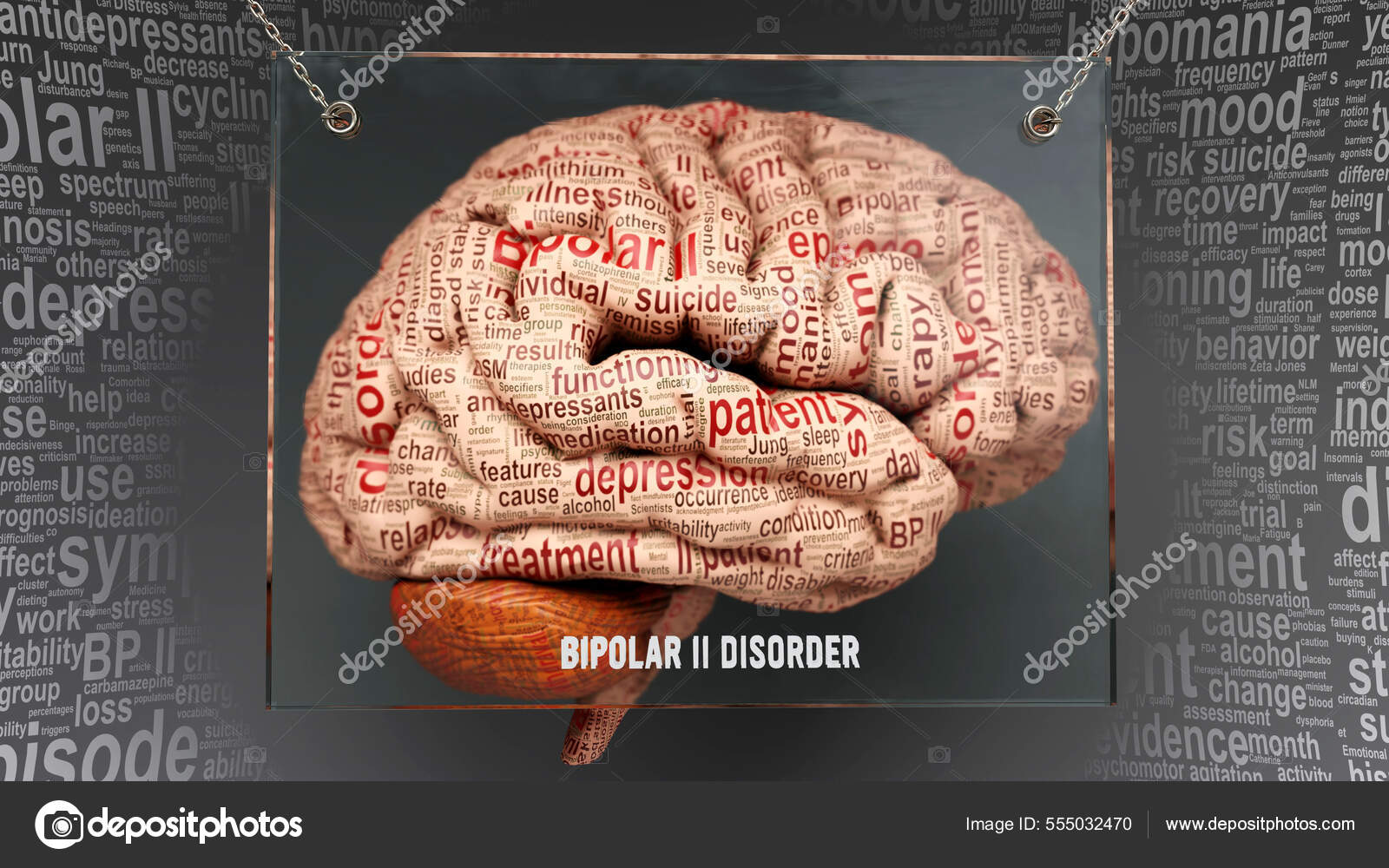 Bipolar Disorder Anatomy Its Causes Effects Projected Human Brain ...