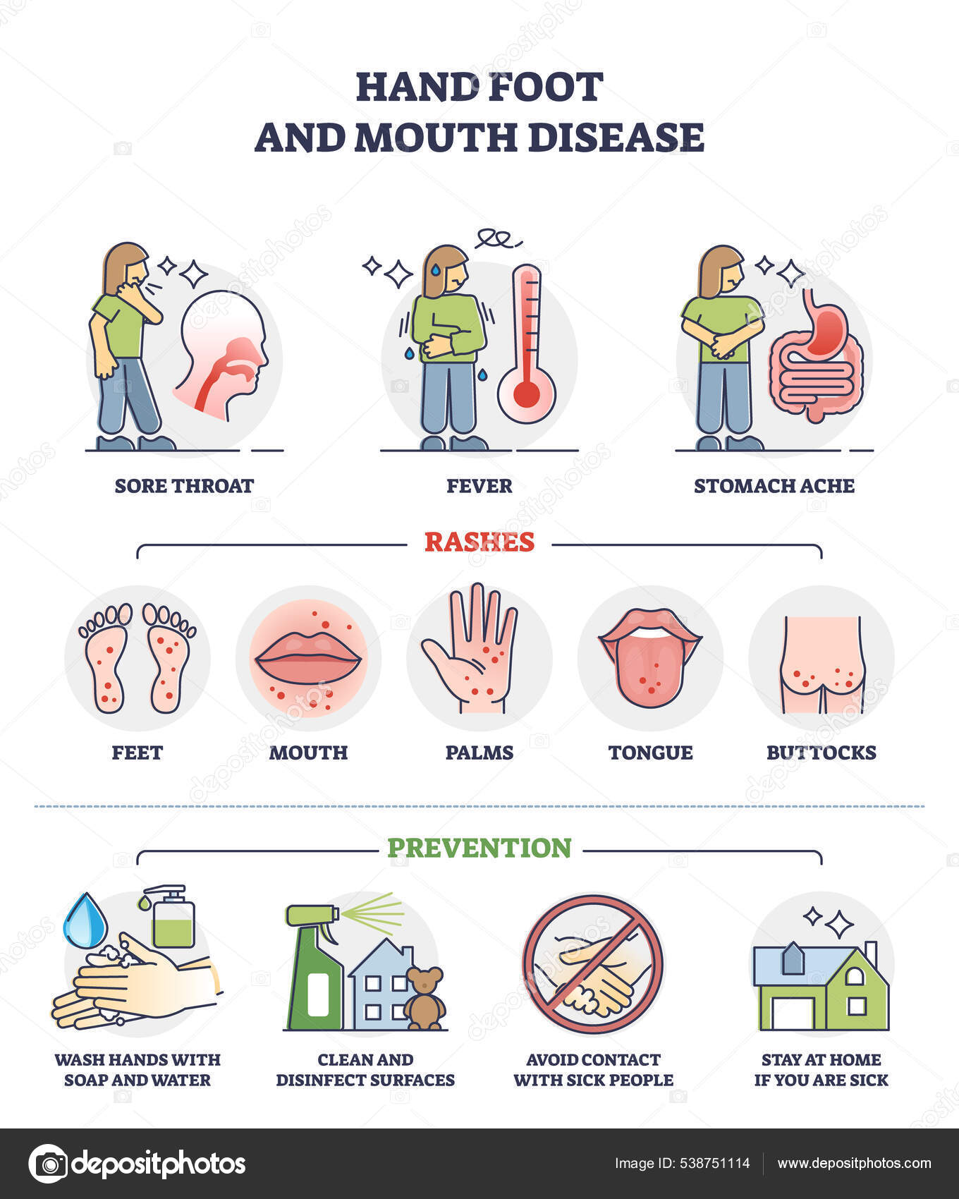 Hand, foot and mouth disease with rashes and how to avoid outline ...