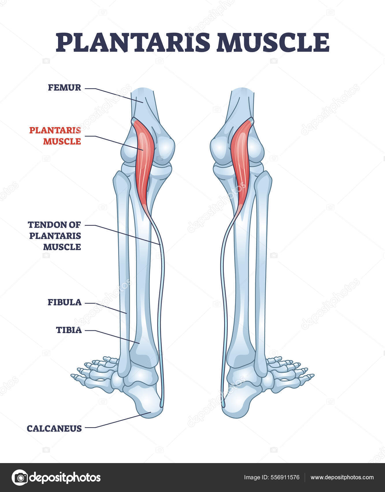 Plantaris muscle as leg superficial posterior compartment outline ...