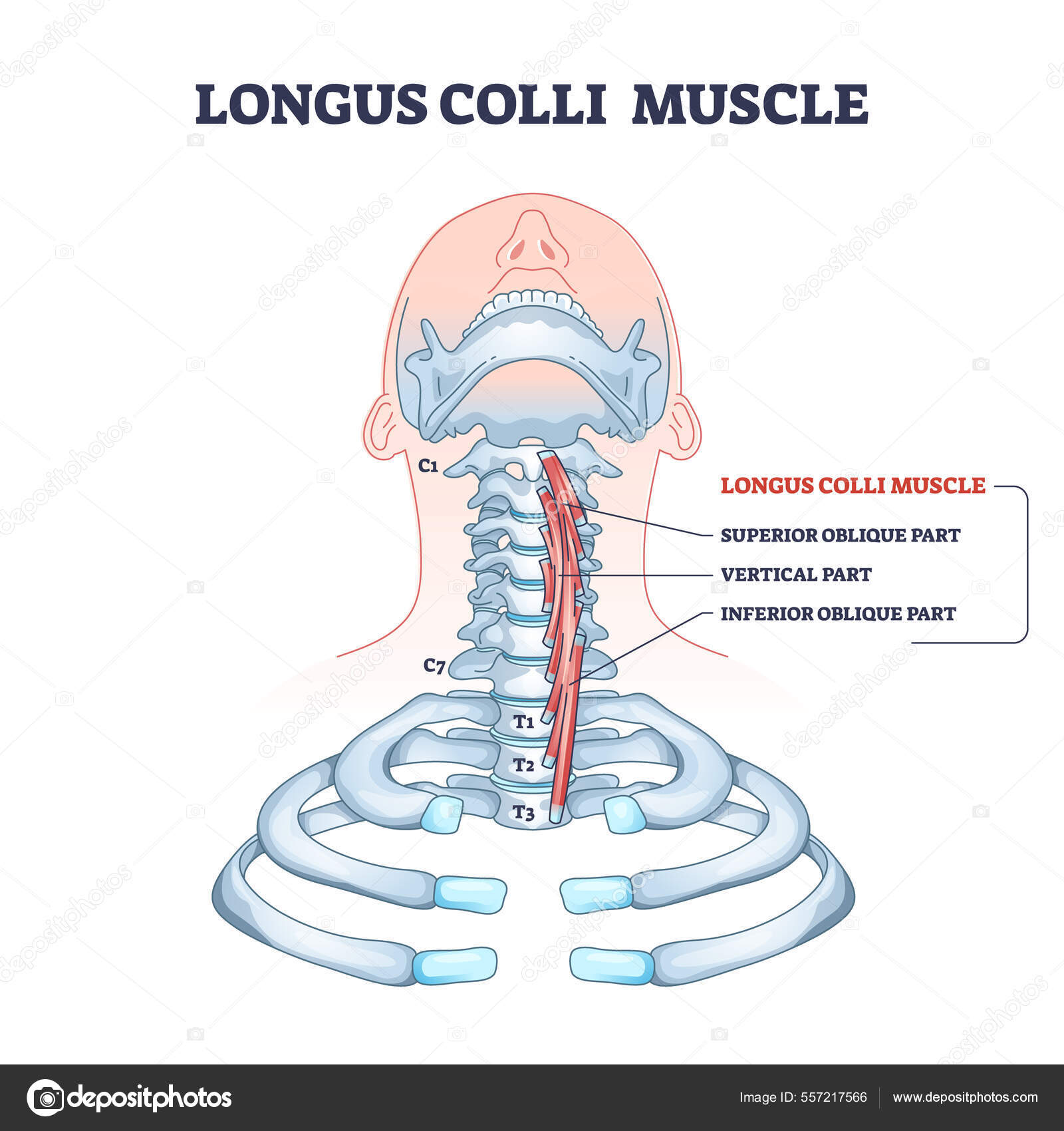 Longus colli muscle with superior, vertical and inferior part outline ...