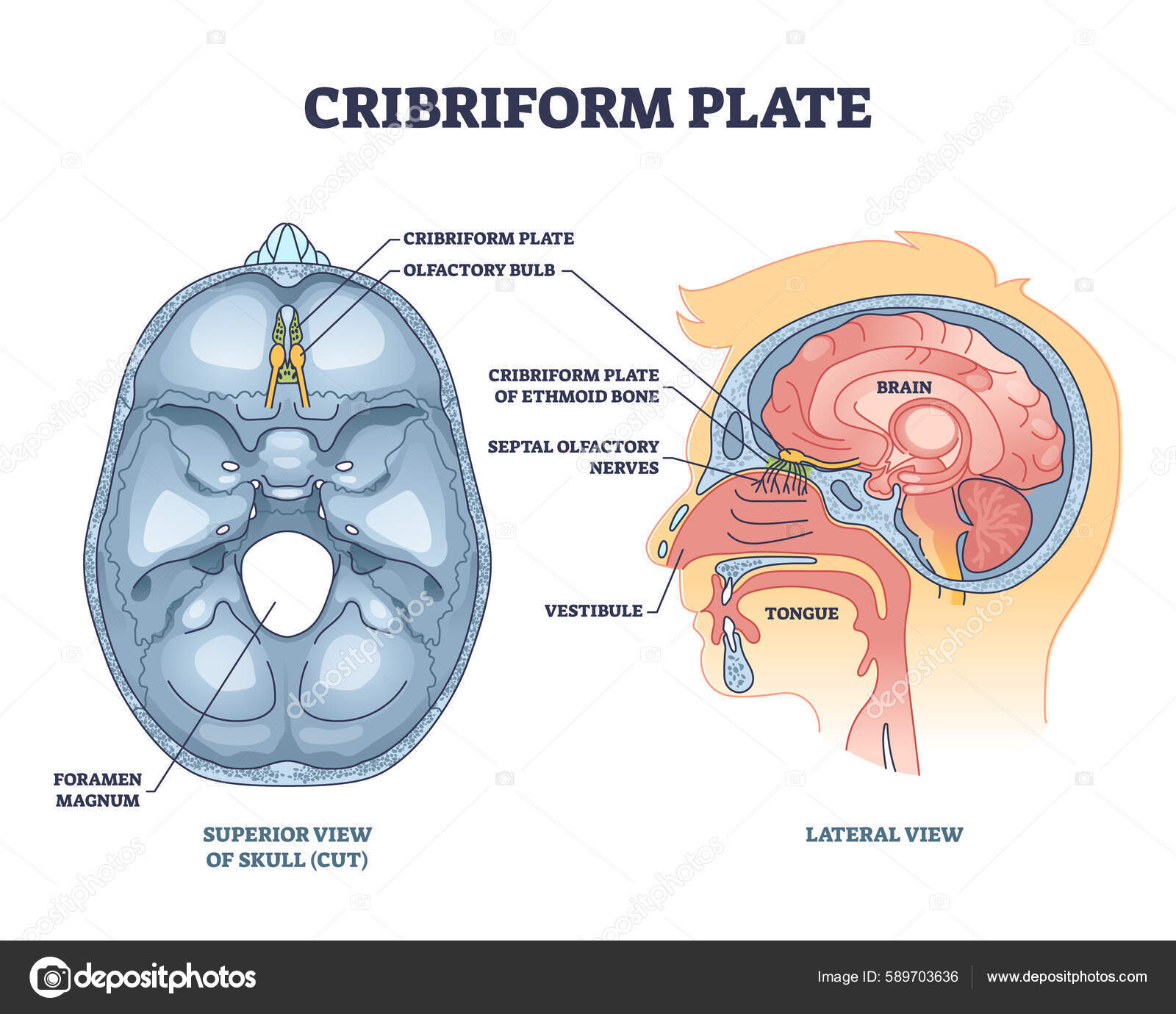 Ct Anatomy Of Cribriform Plate at Sabrina Swensen blog Ct Anatomy Of Cribriform Plate at Sabrina Swensen blog