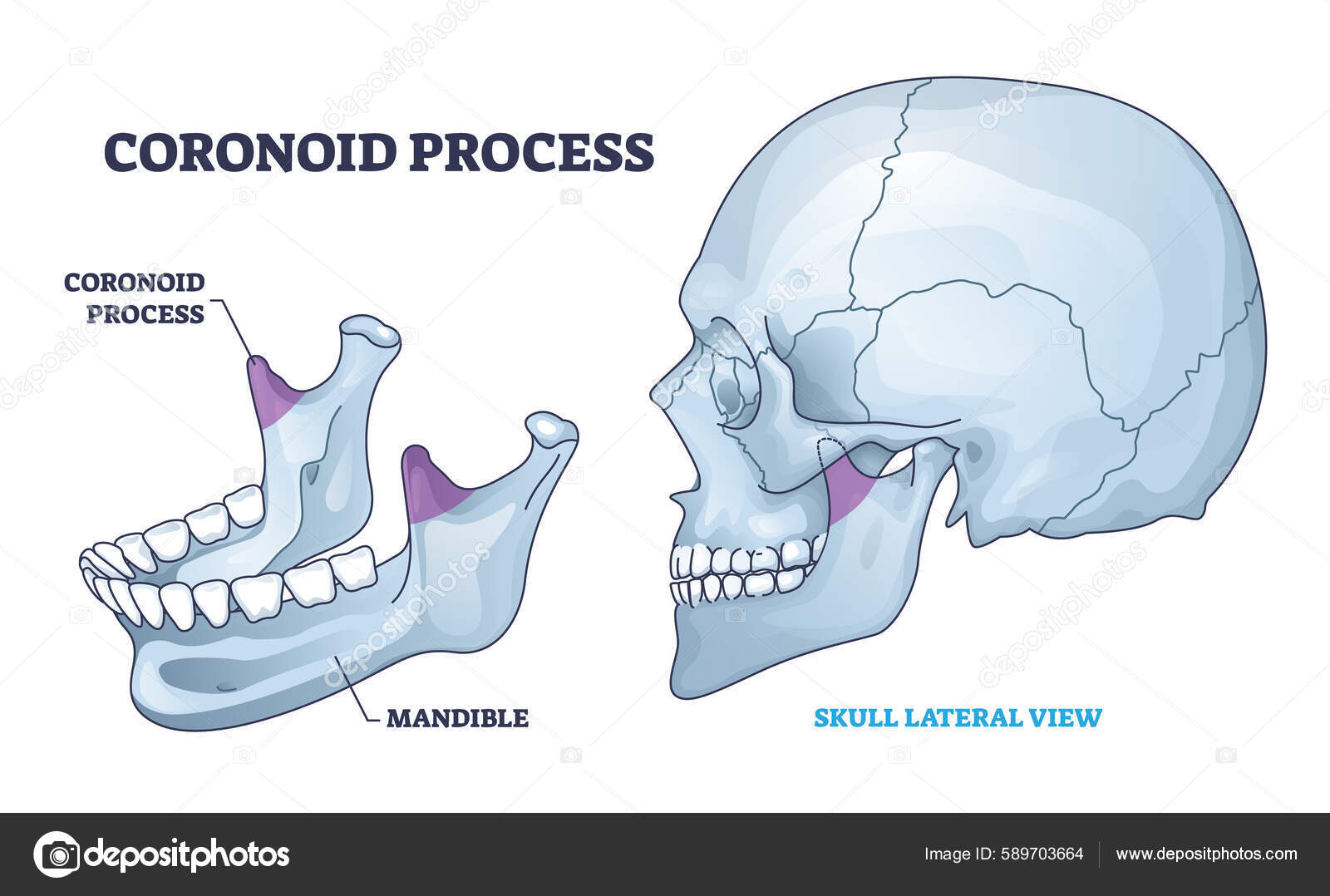 Coronoid Process