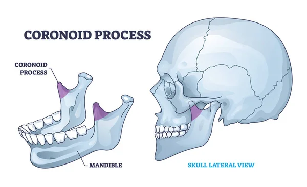 Coronoid process anatomy with isolated bone and skull view outline ...
