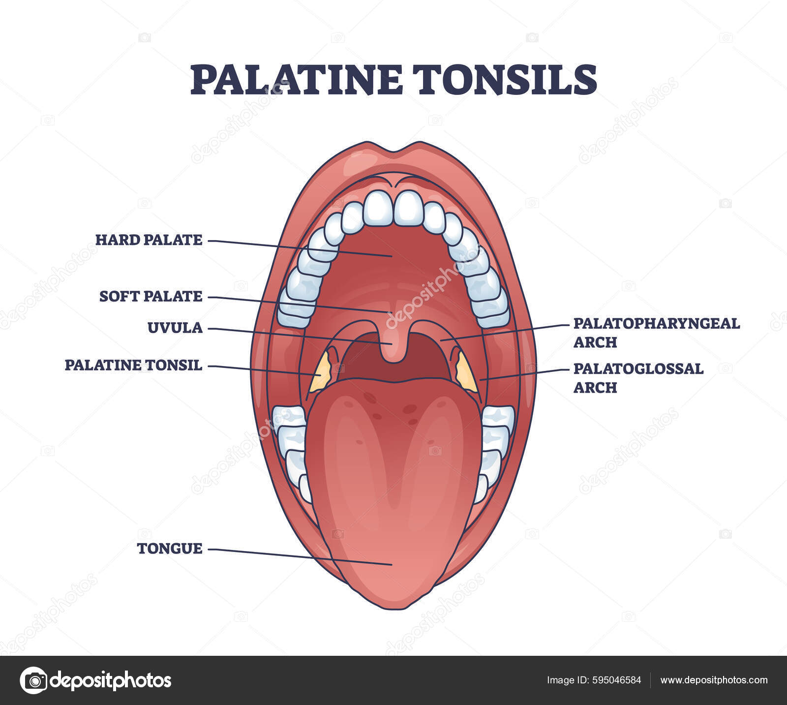 Diagrama De Tonsila Lingual Tonsillitis – Zero To Finals