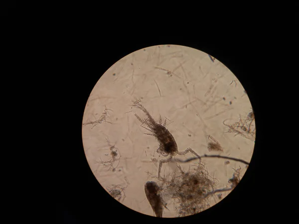 Scabies Mite Microscope