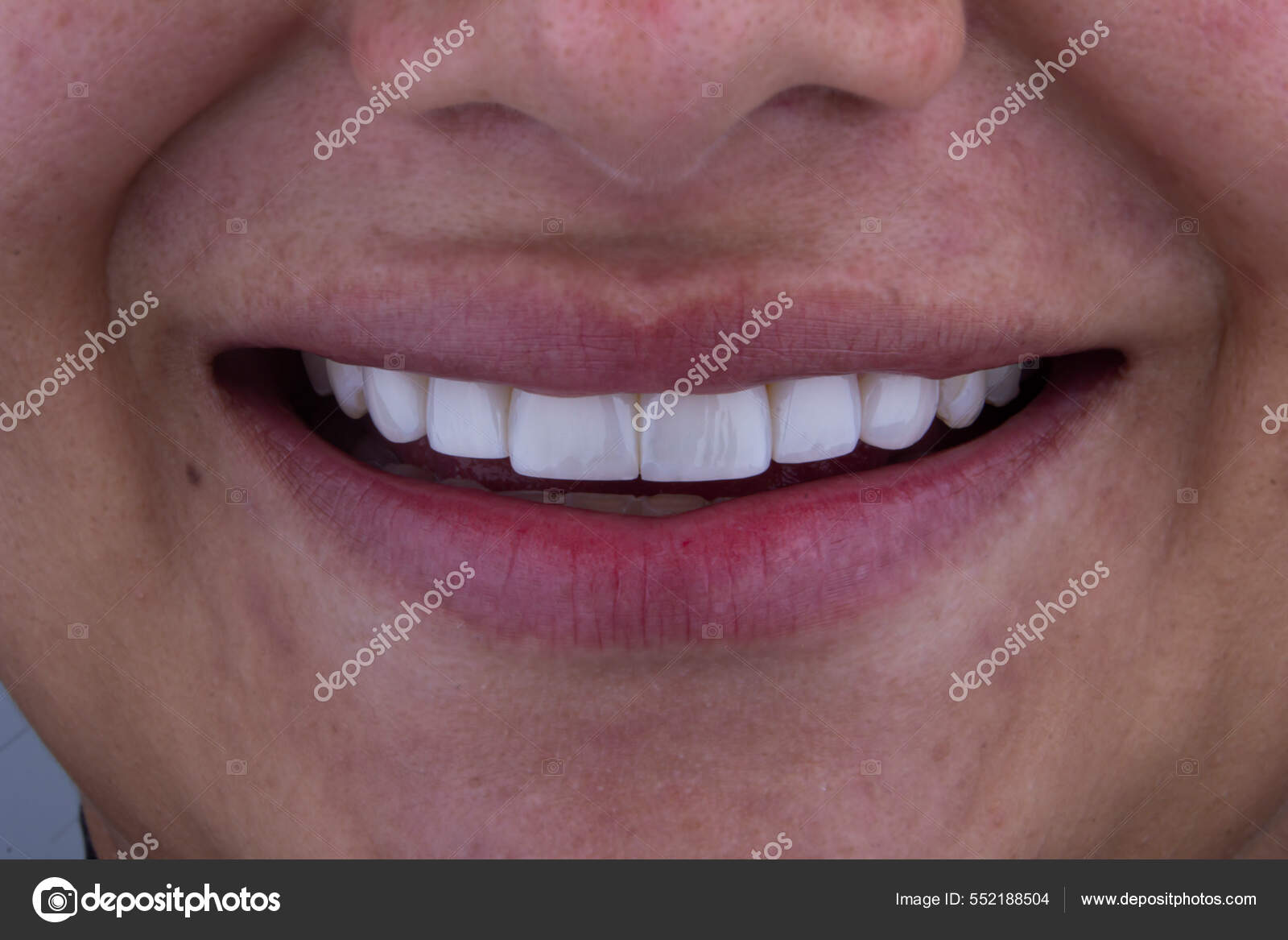 Smile Healthy Beautiful Teeth Stock Photo by ©nandofilms 552188504
