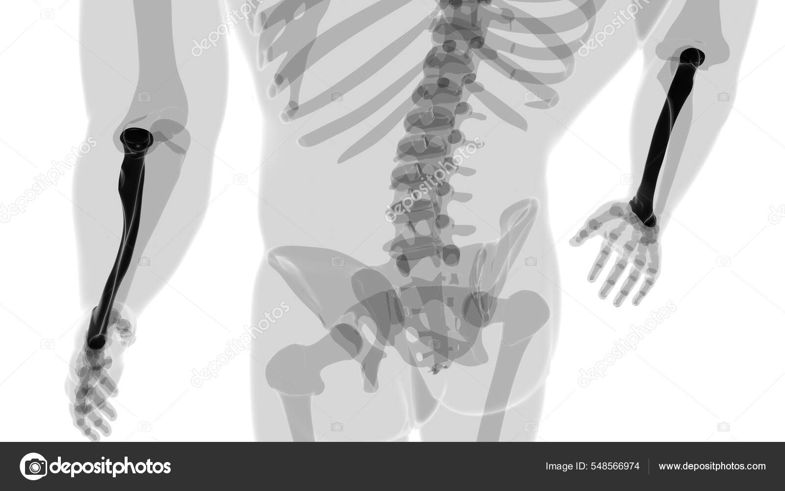 Rendimiento Del Hueso Del Radio Anatomía Del Esqueleto Humano Para ...