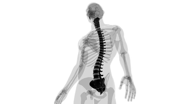 Kyphosis kyphosis Stock Photos, Royalty Free Kyphosis kyphosis Images ...