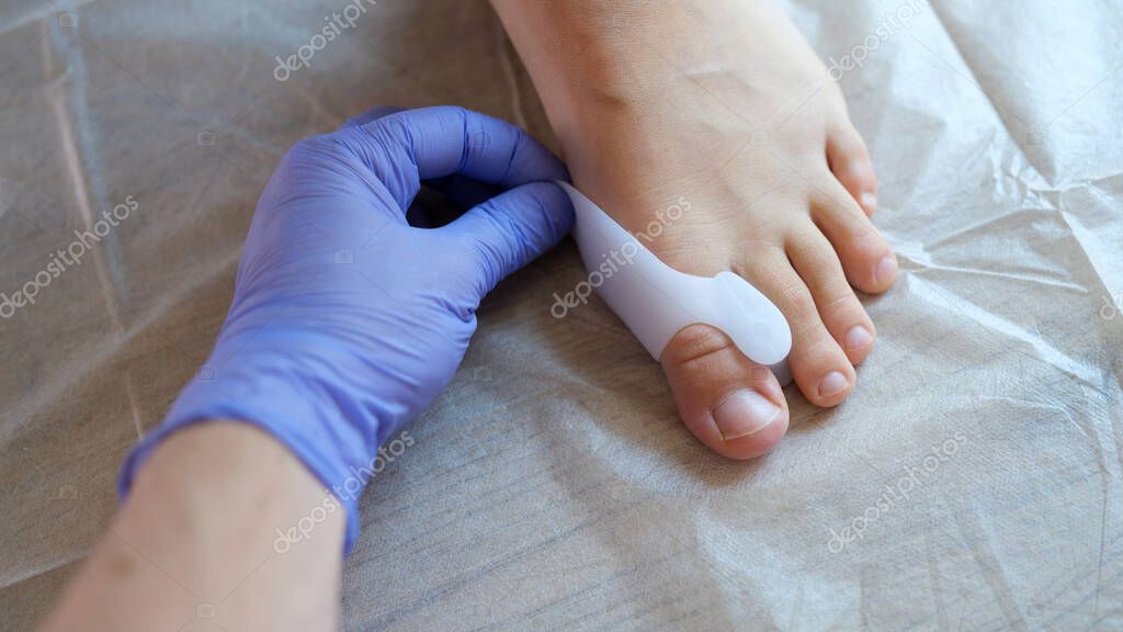 Vista superior del médico ortopedista aplicando aparato ortopédico para ...