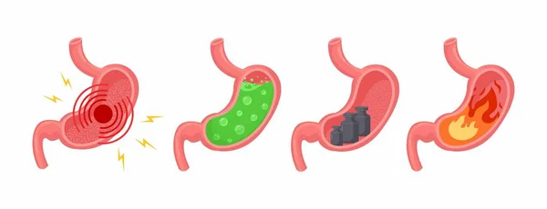 Anatomi Tubuh Manusia Poster Organ Dalam Wanita Vektor Ilustrasi ...