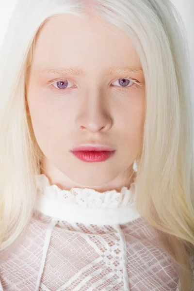 Albino Model