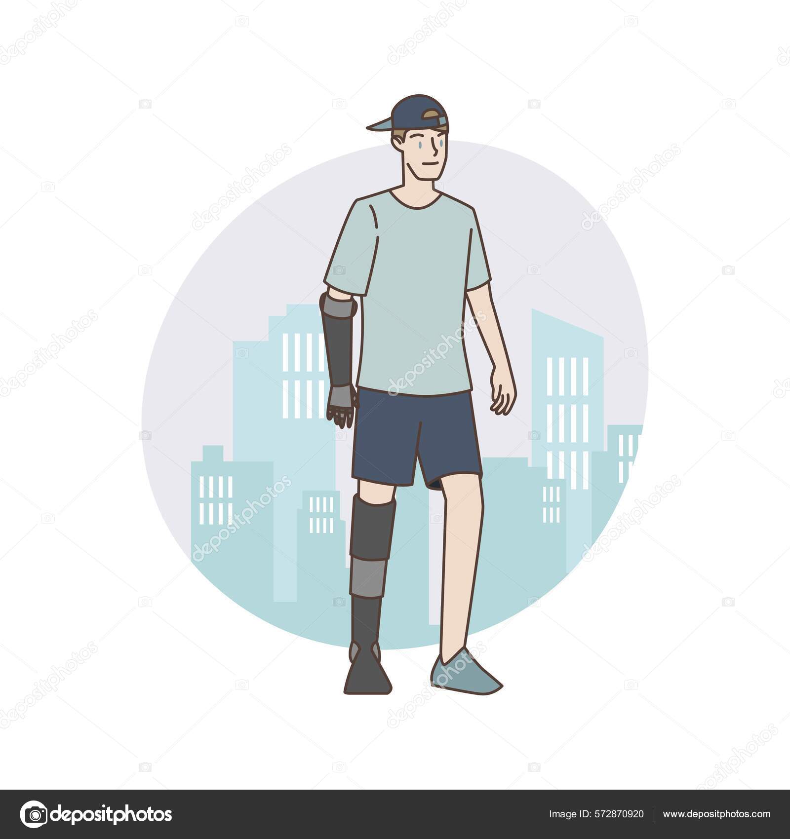 Personas Con Discapacidad Persona Amputada Brazo Pierna Usar Prótesis ...