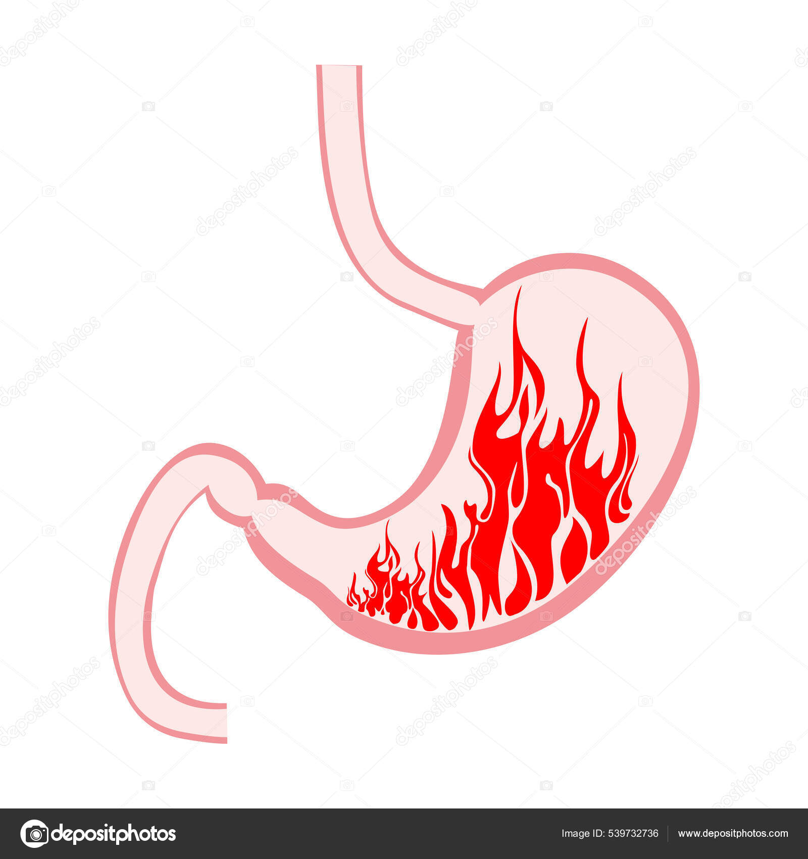Stomach Fire Excessive Acidity Indigestion Stomach Disease Gastric ...