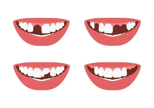Missing teeth Vector Art Stock Images | Depositphotos