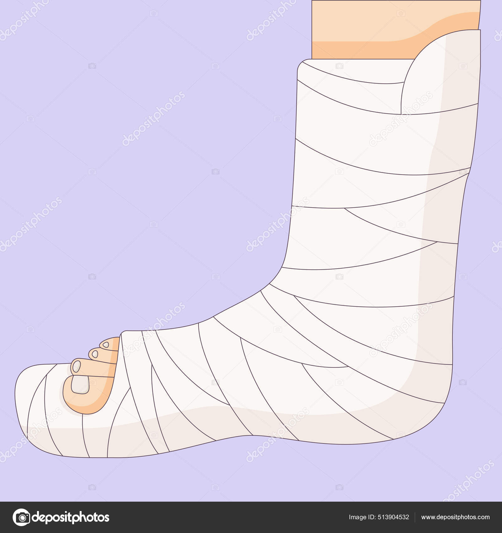 Voet Gips Clipart Tsjip | Beterschapskaart | Iets Gebroken | Greetz