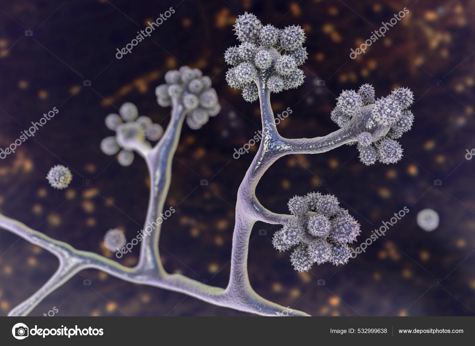 Mucormycosis Microscopic