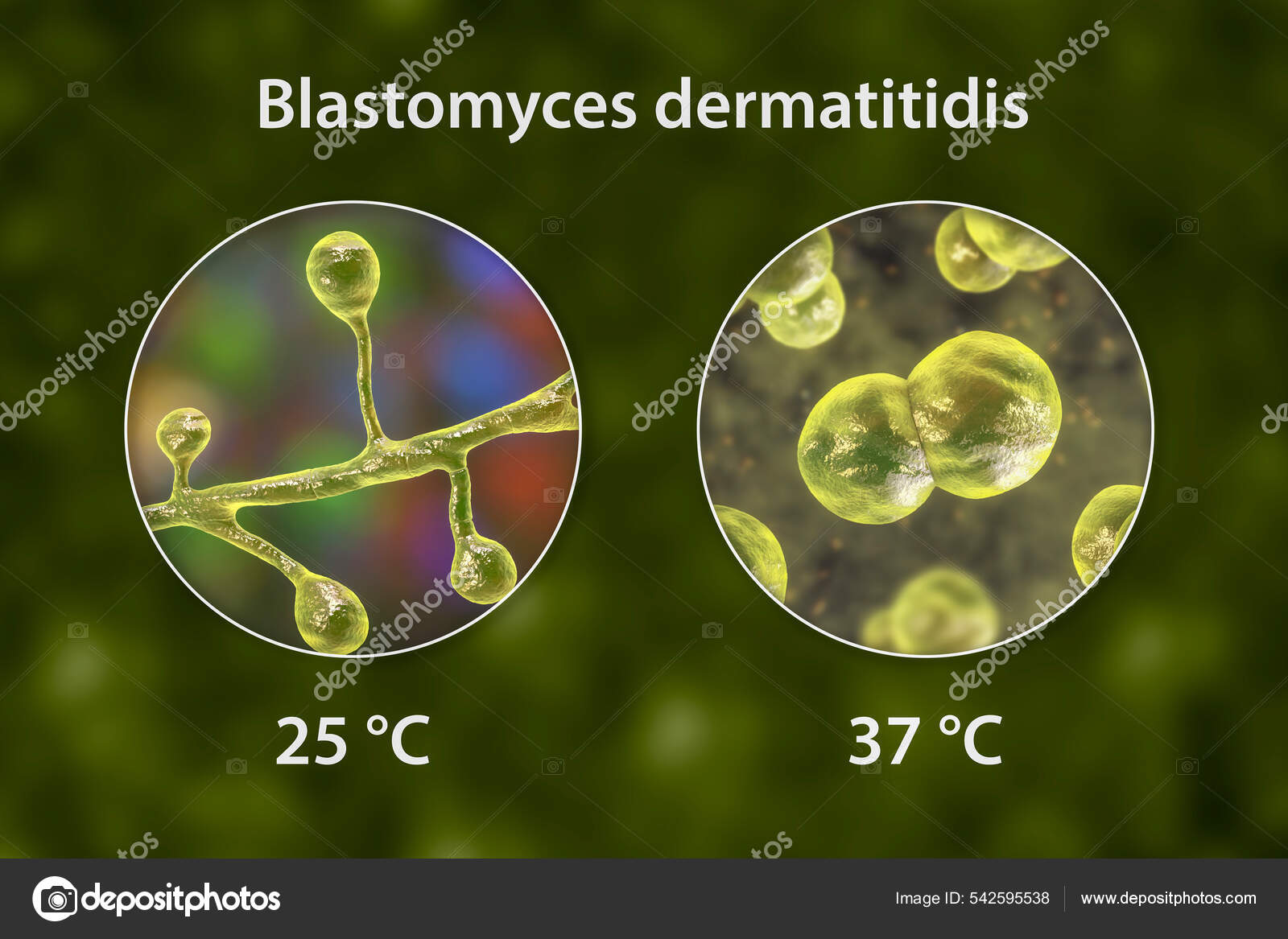 Blastomyces Dermatitidis