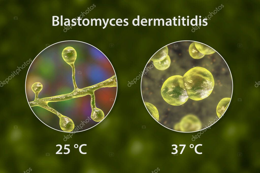 Blastomyces dermatitidis fungi, el agente causal de la blastomicosis en ...