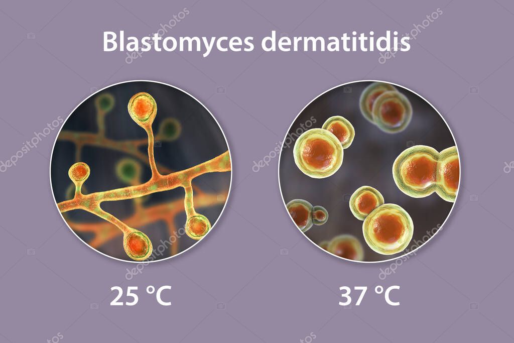 Blastomyces dermatitidis fungi, el agente causal de la blastomicosis en ...
