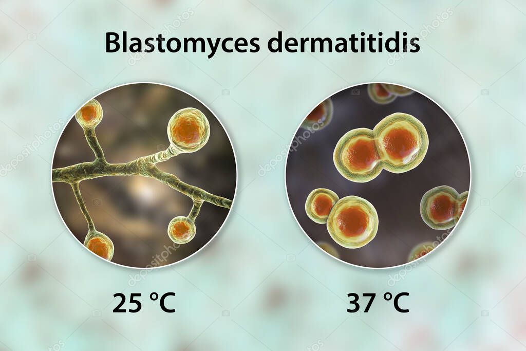 Blastomyces dermatitidis fungi, el agente causal de la blastomicosis en ...