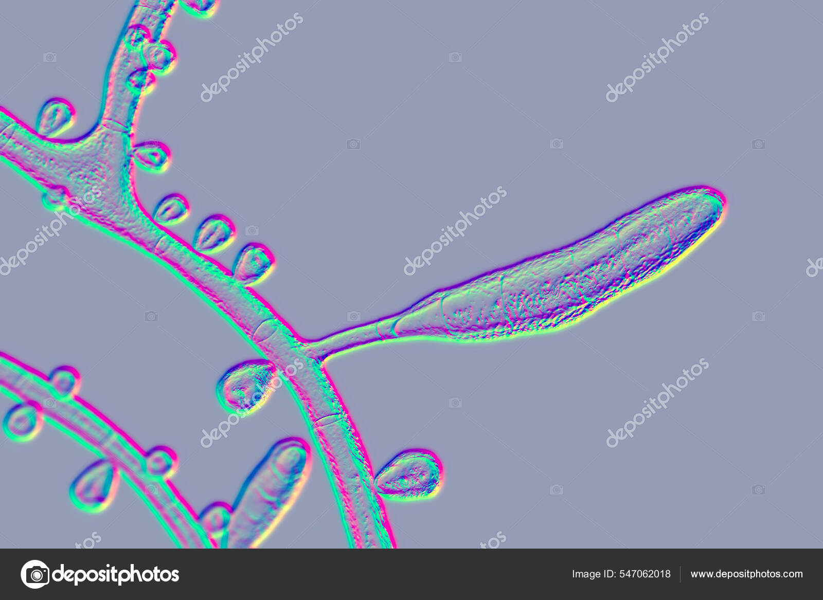 Hongo Trichophyton Rubrum Ilustración Que Muestra Macroconidium ...