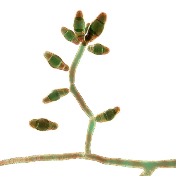 Curvularia Stock Photos, Royalty Free Curvularia Images | Depositphotos