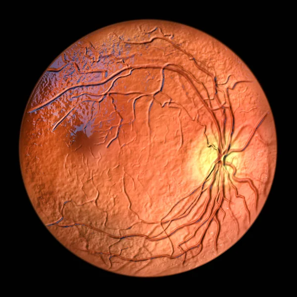 Normal Eye Retina Ophthalmoscope View Scientific Illustration Showing ... Normal Eye Retina Ophthalmoscope View Scientific Illustration Showing ...