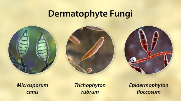 Hongos dermatofitos, ilustración 3D. Microsporum, Trichophyton, y ...