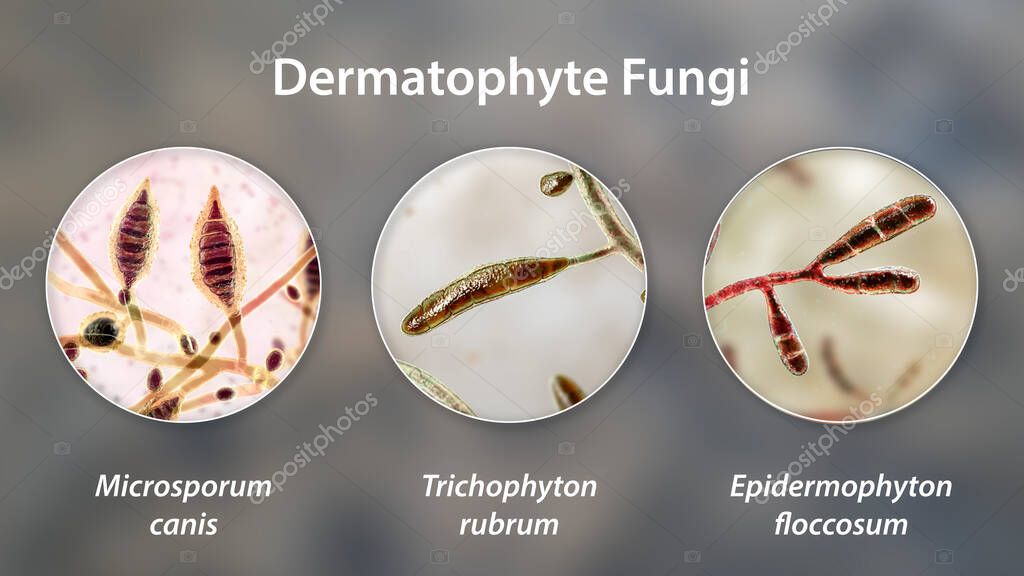 Hongos dermatofitos, ilustración 3D. Microsporum, Trichophyton, y ...
