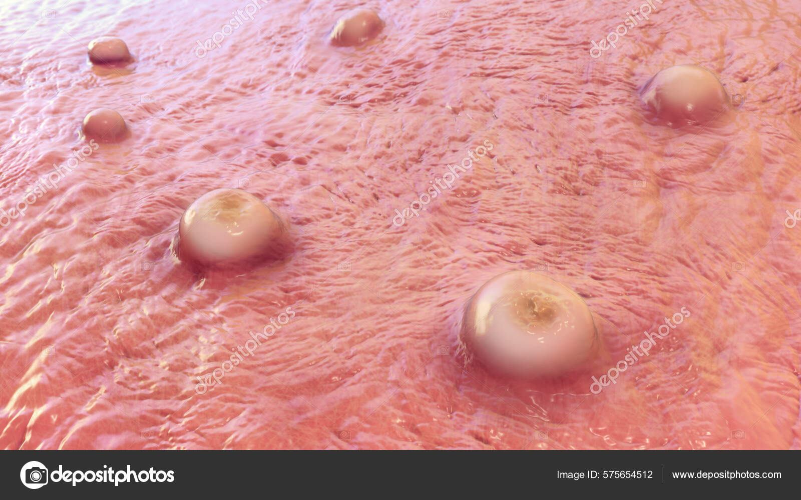 Skin Lesions Monkeypox Smallpox Molluscum Contagiosum Other Poxviridae ...