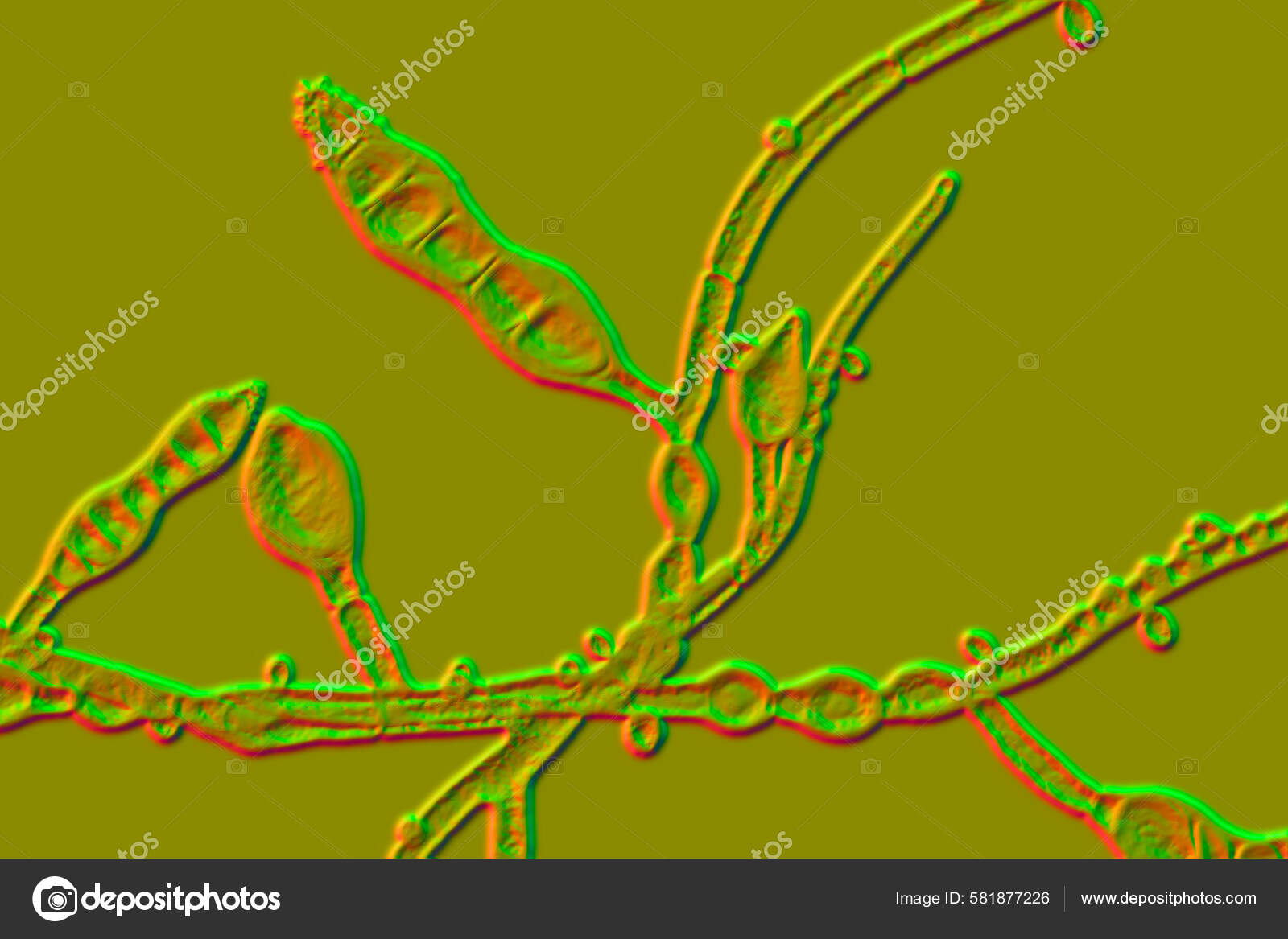 Microscopic Fungi Microsporum Audouinii Illustration Anthropophilic ...