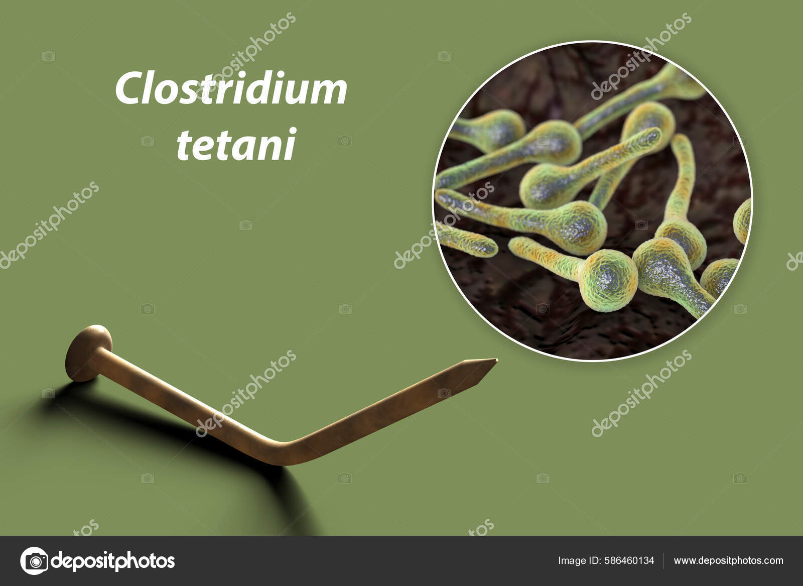 Tetanus Bacteria Clostridium Tetani Rusty Metal Nail Common Cause ...