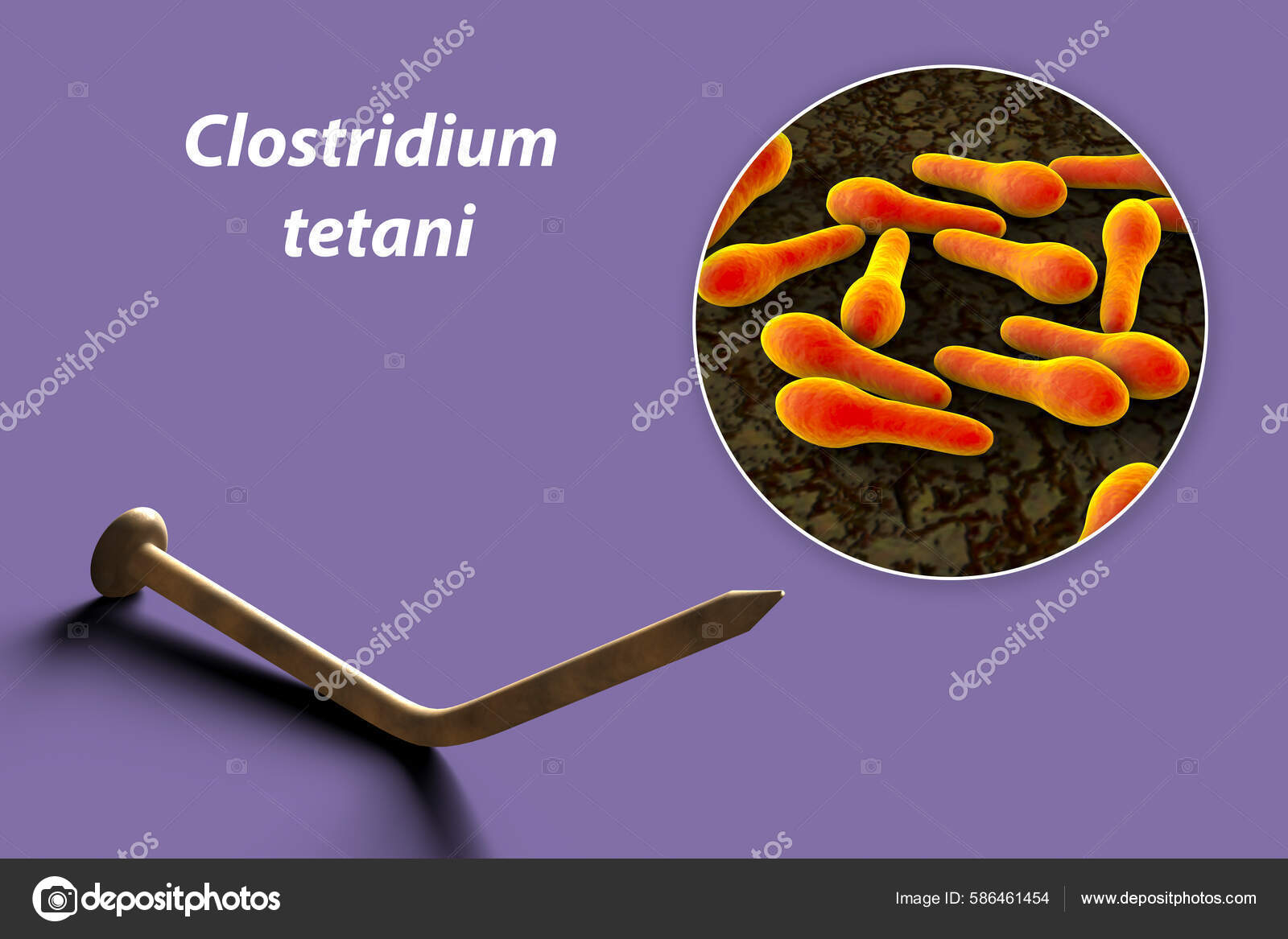 Tetanus Bacteria Clostridium Tetani Rusty Metal Nail Common Cause ...