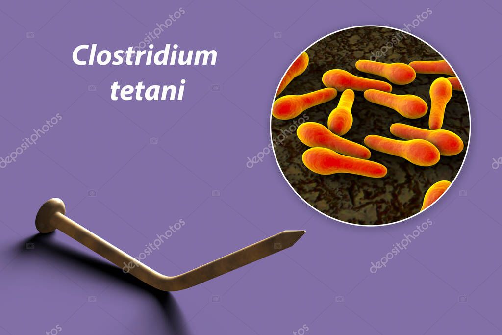 Tetanus. Bacteria Clostridium tetani and a rusty metal nail as a common ...