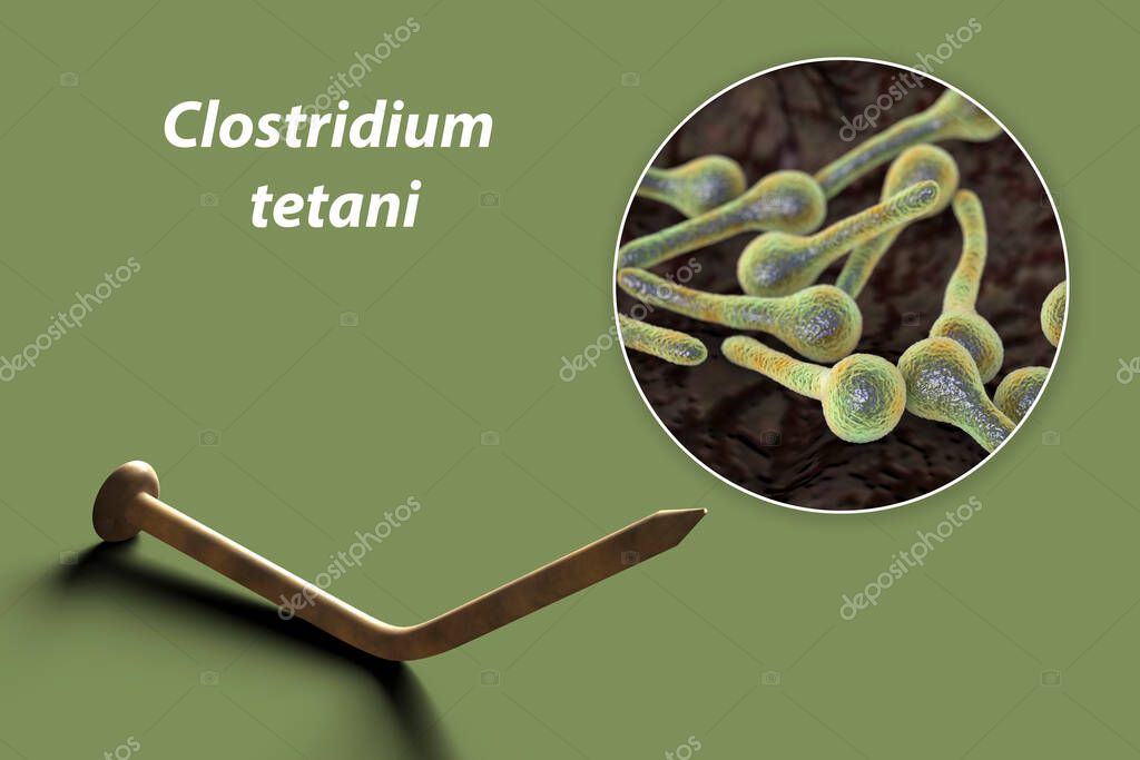 Tetanus. Bacteria Clostridium tetani and a rusty metal nail as a common ...