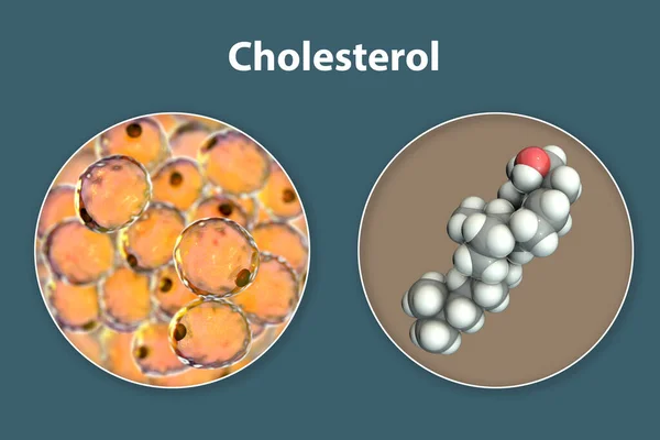Fat adipose cells and molecule of cholesterol, 3D illustration ...