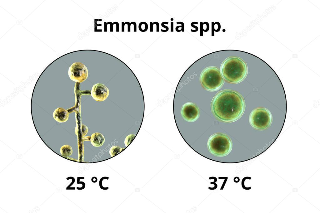 Emmonsia hongos microscópicos patógenos, ilustración 3D. El agente ...