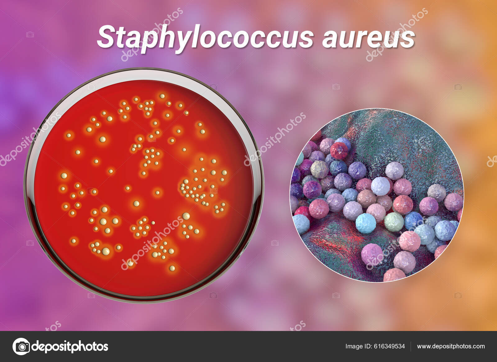 Bacterias Staphylococcus Aureus Colonias Medio Agar Sangre Oveja Vista ...