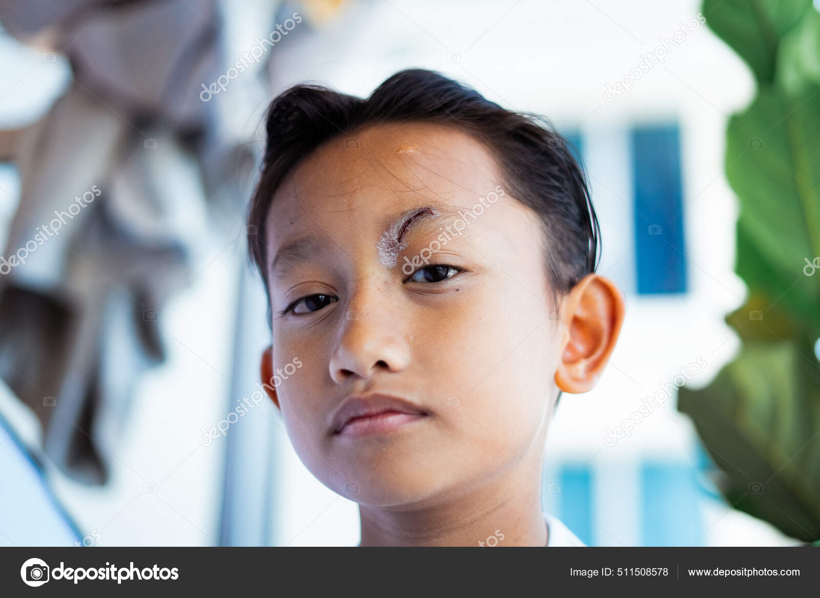 Healed Minor Cut Wound Surgical Glue Stiches Scar Left Eyebrow Stock ...